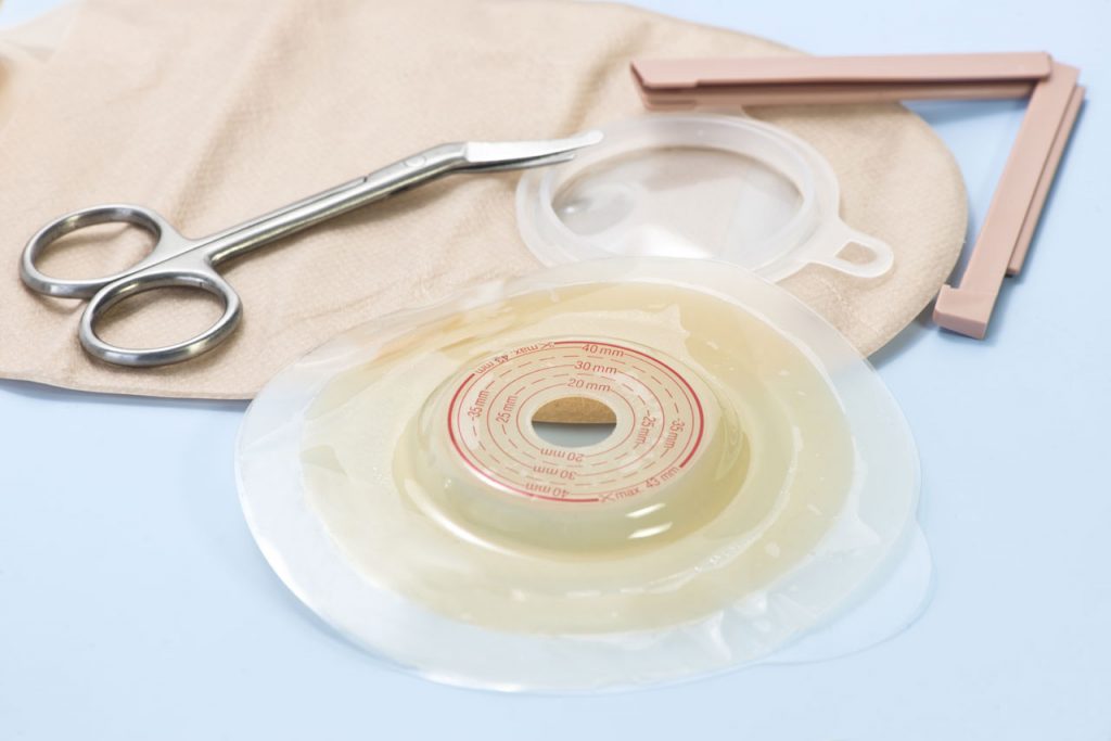 Ostomy Wound Care