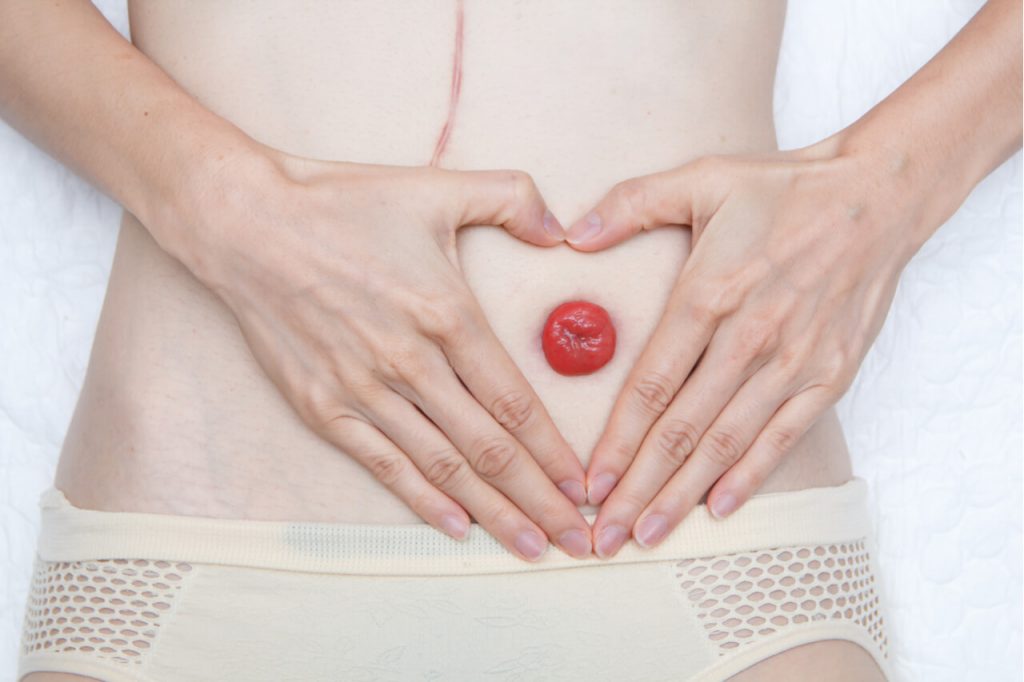 The End Ostomy Overview | https://www.bostonoab.org