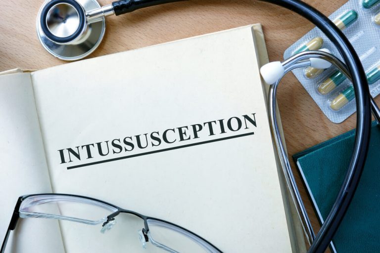 Intussusception Treatment: Effective Solutions for Pediatric Patients