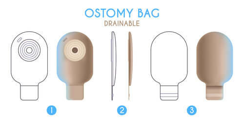 How to Change a Colostomy Bag | Ostomy Association of Boston