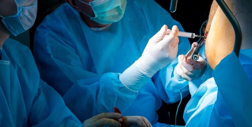 Life Expectancy After Diverticulitis Surgery | Ostomy Association of Boston