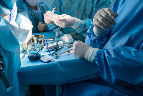 Life Expectancy After Diverticulitis Surgery | Ostomy Association of Boston